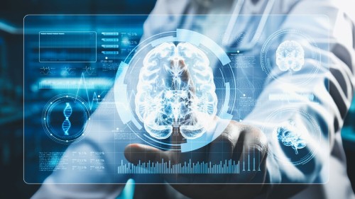 Upconversion nanoparticles in bioimaging