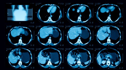 Computed Tomography (CT) Datasets