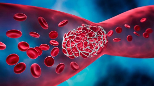 Antithrombotic therapy