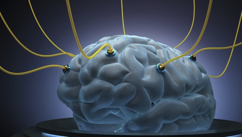 Neuroprosthetics in systems neuroscience and medicine