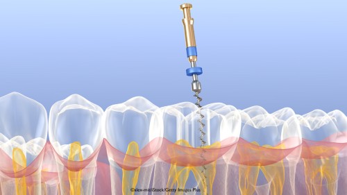 Endodontics