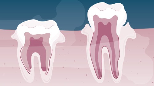 Biomineralization in health and disease