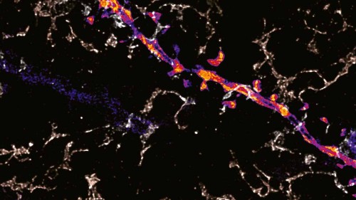 Fluorescent protein biosensors
