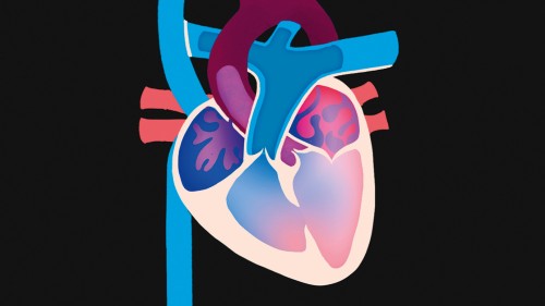 Single-ventricle heart defects