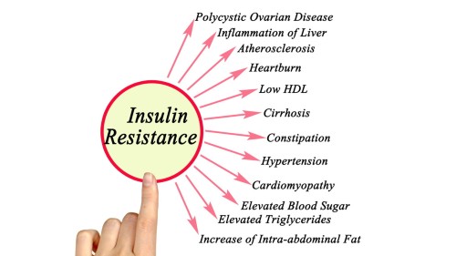 Insulin-resistance beyond diabetes Insulin-resistance beyond diabetes