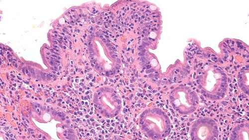 Intestinal stem cell niche