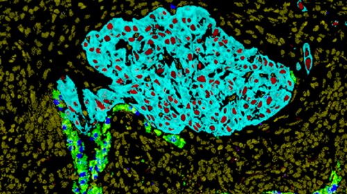 Advances in Translational Pathology