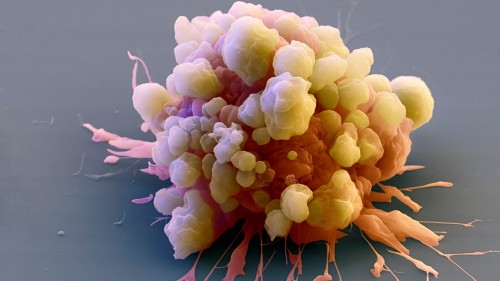 Mechanisms and outcomes of programmed cell death