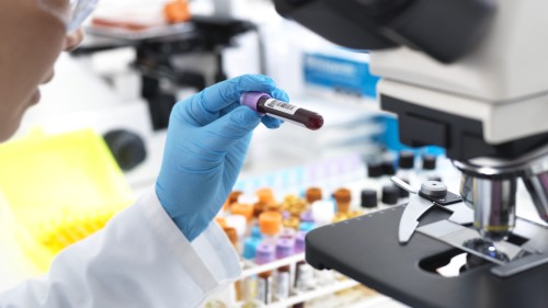 Infectious disease diagnostics
