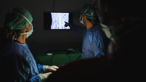 Intraoperative imaging: probes, equipment, and processing