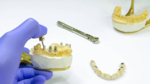 Corrosion of Medical Implants and Devices