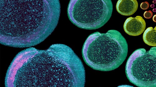 The future of bioimage analysis