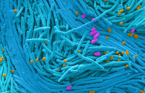 Human Microbiome Project, part 2