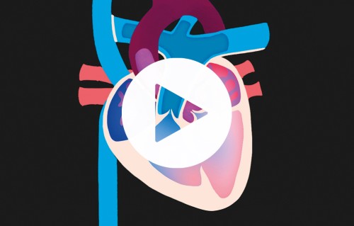 Single-ventricle heart defects