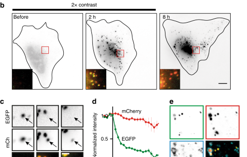 Stem Cells and Disease