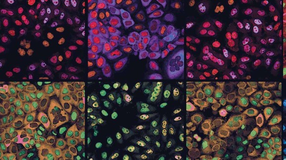 Series on Autophagy