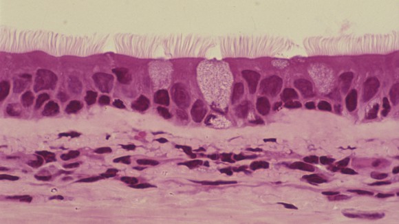 Columnar Epithelium With Goblet Cells