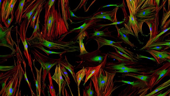 Cancer-associated fibroblasts