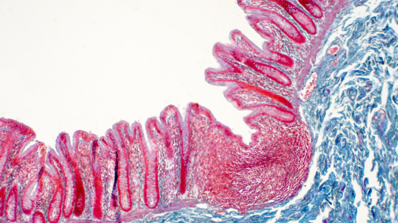 Leveraging mucosal immunity