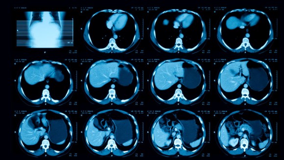 Computed Tomography (CT) Datasets