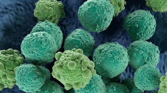 Minimal residual disease