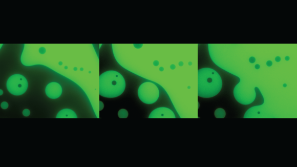 Protein Liquid-Liquid Phase Separation in diseases