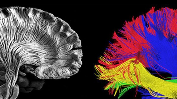 Human brain MRI reproducibility