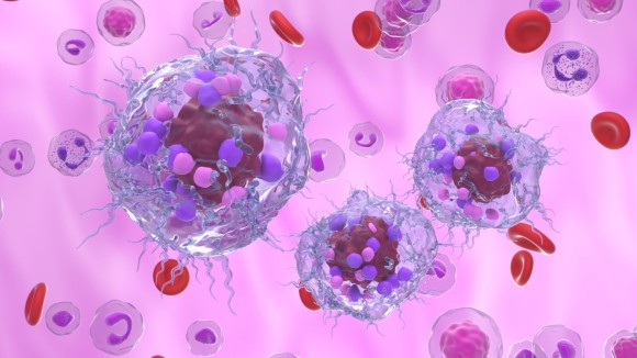 Neuroendocrine tumors