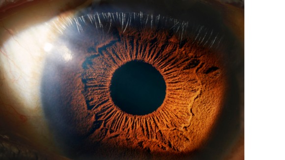 Ophthalmic microbiome