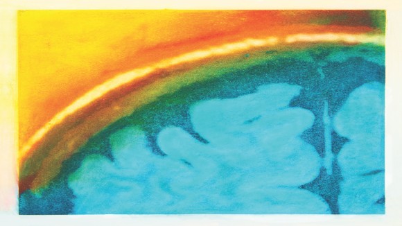 Focus on neurotechnologies