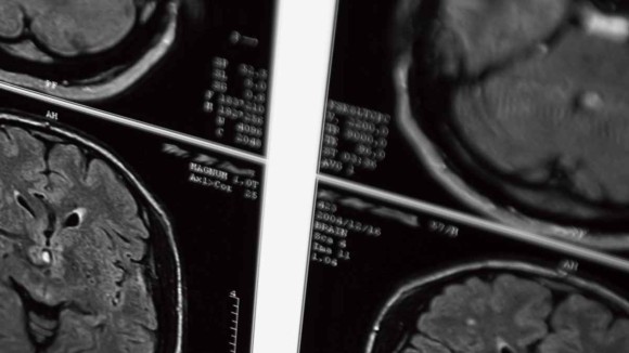 Machine Learning in Medicine