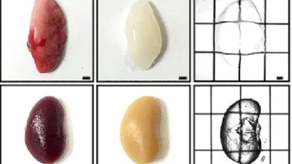 Tissue clearing protocols
