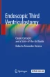 Surgical Technique of Endoscopic Third Ventriculostomy (ETV) | SpringerLink