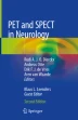 SISCOM (Subtraction Ictal SPECT with Coregistration to MRI) | SpringerLink