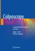International Nomenclature of Colposcopy | SpringerLink