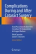 Small Incision Cataract Surgery (SICS = Modified ECCE) | SpringerLink