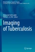 Pathophysiology of Tuberculosis and Microbiological Diagnosis ...