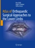 Direct Lateral Approach to the Hip: Hardinge | SpringerLink