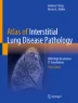 Usual Interstitial Pneumonia (UIP) | SpringerLink
