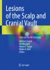 Benign Lesions and Neoplasms of the Scalp and Calvarium | SpringerLink