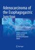 Siewert Classification of Adenocarcinoma of the Esophagogastric ...