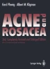 Solar Comedones (Favre-Racouchot’s Disease) | SpringerLink