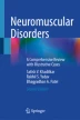 Distal Hereditary Motor Neuropathy (dHMN) | SpringerLink