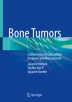 Primary Bone Tumours | SpringerLink