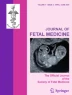 Fetal Flat-Facies on Prenatal Ultrasound: Is it Chondrodysplasia ...