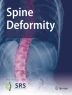 The hidden asymmetry: facet joint tropism as a clue to spinal ...
