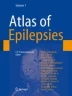 Epilepsy with Generalized Tonic-Clonic Seizures Only | Springer Nature Link