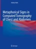 Consolidation, Bulging Fissure Sign or Lobar Consolidation and Air ...