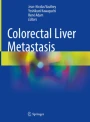 Colorectal Liver Metastasis | SpringerLink