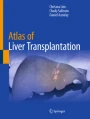 Atlas of Liver Transplantation | SpringerLink